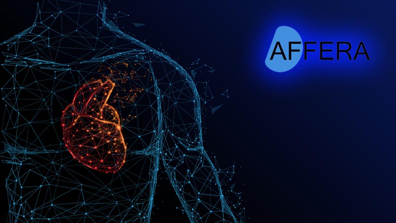 Affera Announces First Patient Treated in SPHERE Per-AF IDE Trial