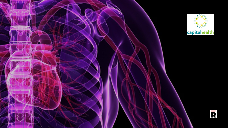 Capital Health Performs First Watchman Implant