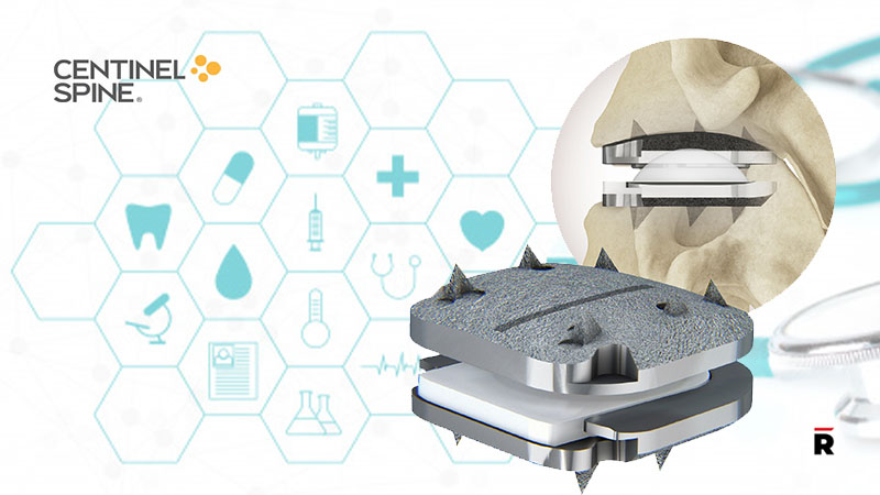 Centinel Spine Announces First Commercial Use of prodisc Cervical