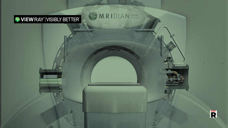 Centre Oscar Lambret Selects ViewRay's MRIdian MRI-Guided Radiation