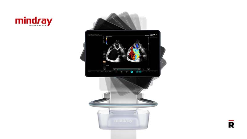 Mindray Redefines the Possibilities of Point of Care Ultrasound (POCUS)