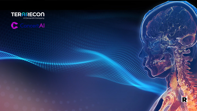 ConcertAI's TeraRecon Adds the Releases of an AI-Assisted Clinical ...