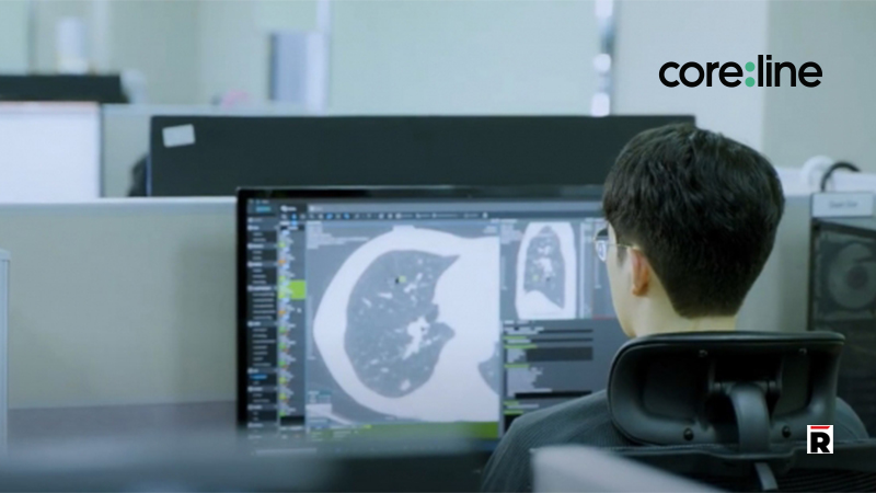 ConcertAI's TeraRecon adds AI-based oncology contouring capabilities ...