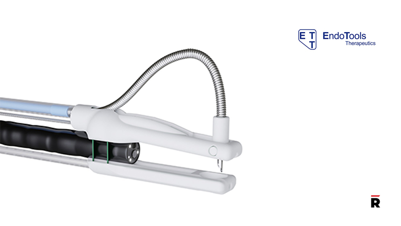 Endo Tools Therapeutics Announces U.S. Commercial Cases Endomina