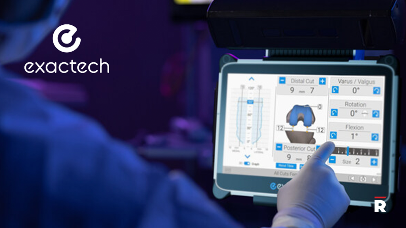 Exactech Unveils New Balancing Tech for Knee Replacements