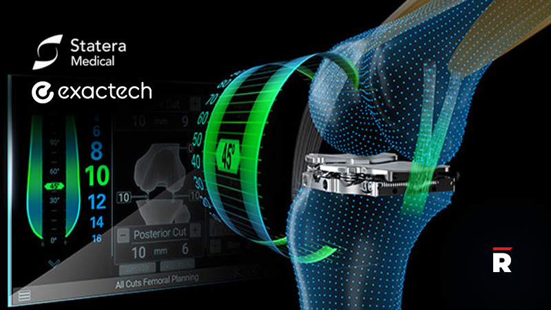 Exactech Partners with Statera Medical to Co-Develop World's First ...