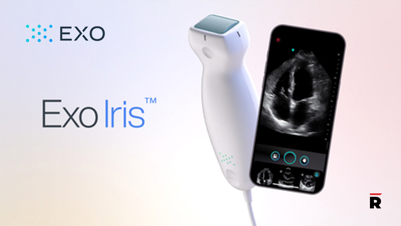 Exo® Introduces a New Age of Ultrasound with Exo Iris™