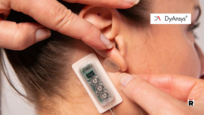FDA Clears DyAnsys Neurostimulation Device First Relief to treat Diabetic