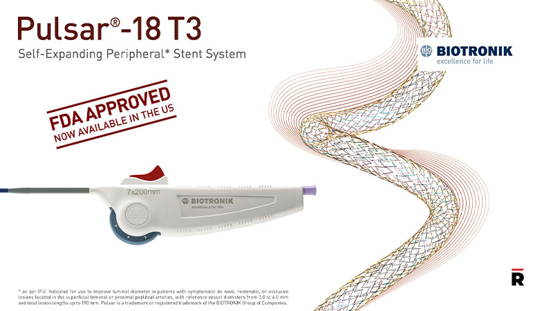 Peripheral Tri-axial 4-French Stent System Receives FDA Approval