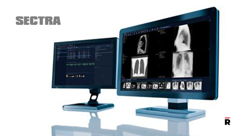 Kent NHS Trusts in the UK to Modernize Patient Diagnostics With Sectra