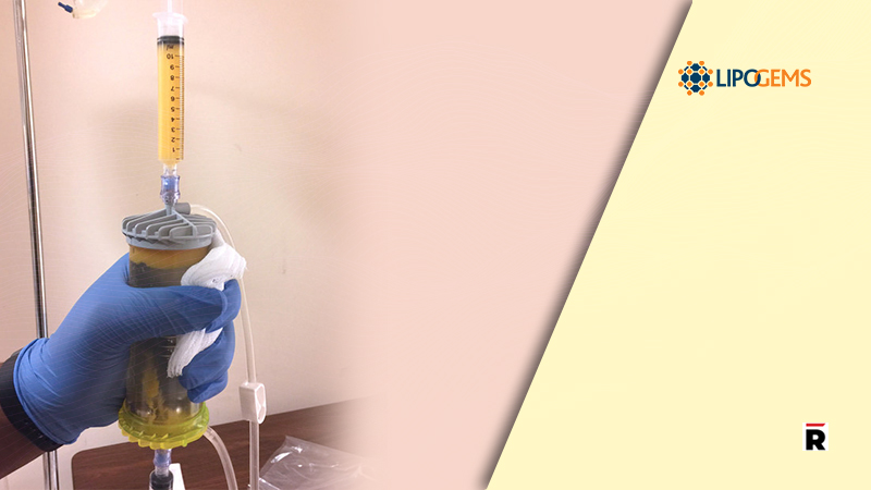 Lipogems Raises €12.5M To Accelerate Expansion in Knee Osteoarthritis