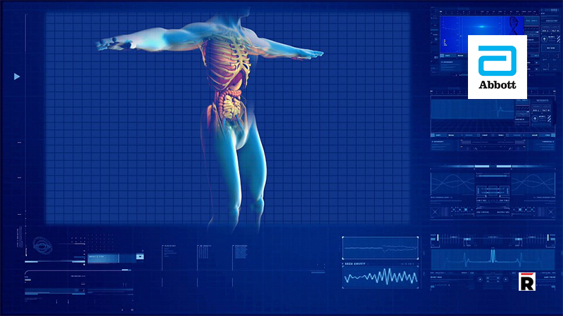 Abbott Minimally Invasive Structural Heart Technologies