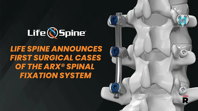 Life Spine Announces FDA 510(k) Clearance for the ARx® SAI Spinal ...