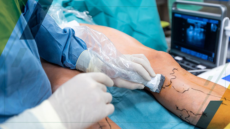 Limb/Leg Lengthening Surgery: Unlocking New Heights