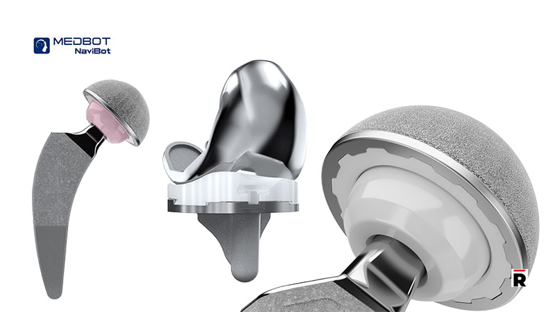 MicroPort MedBot NaviBot Announces Use Skywalker Robot