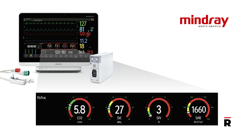 Mindray's Collaboration with Edwards Lifesciences Marks the First ...