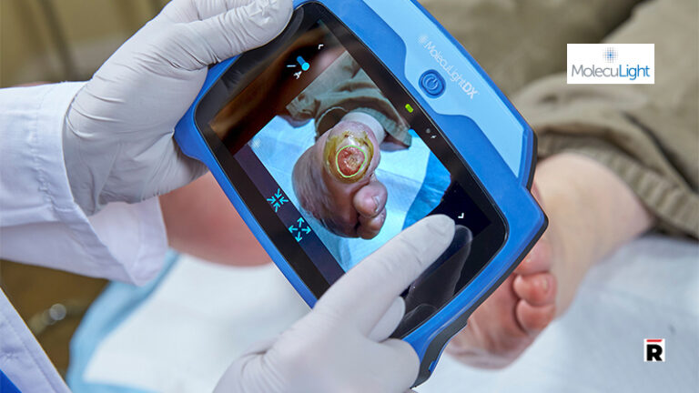 Wound Devices Awarded Group Purchasing Agreement with AllSpire