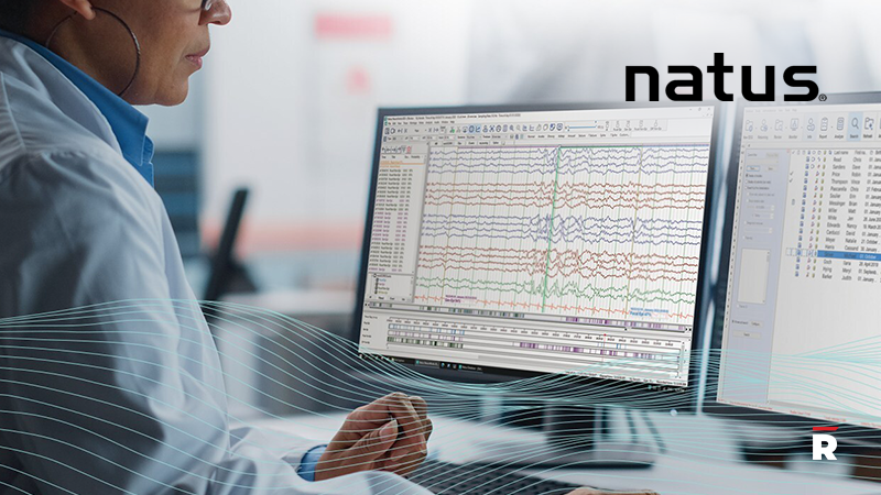 Natus Launches autoSCORE: AI for Expert-Level EEG Interpretation