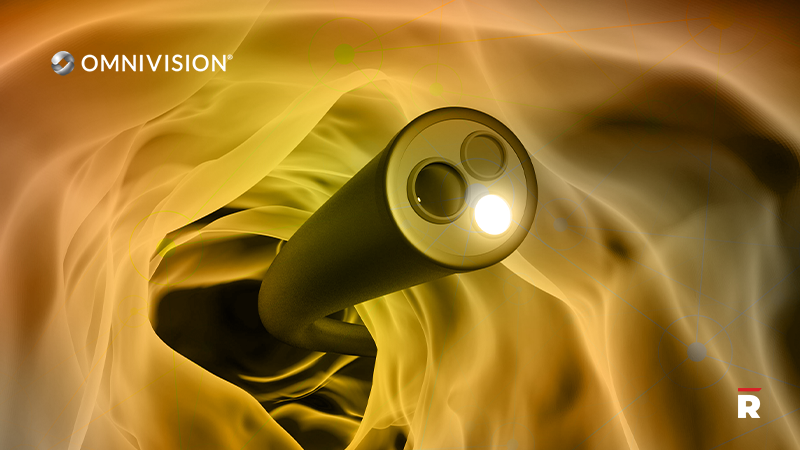 OMNIVISION Announces Smallest Camera Module for 3D Intraoral Dental ...