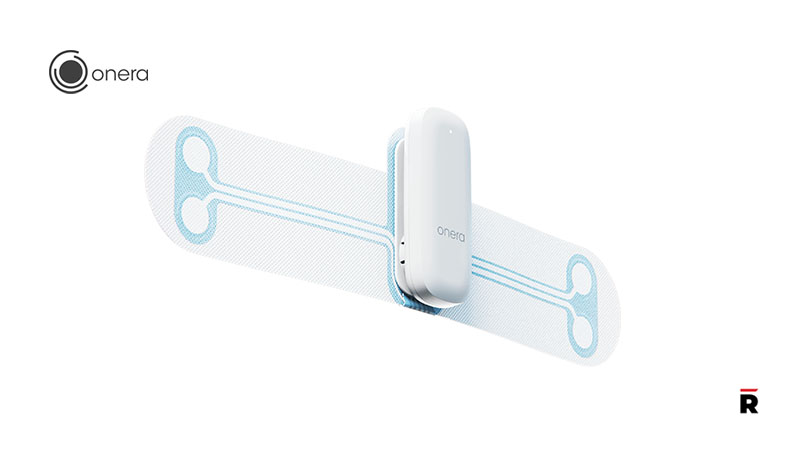 Onera Launches Innovative Sleep Diagnostics Solution in Europe