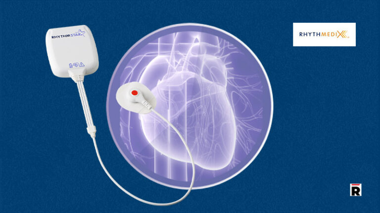 RhythMedix Expands Monitoring Capabilities of Its RhythmStar System RhythMedix Expands Monitoring Capabilities of Its RhythmStar System