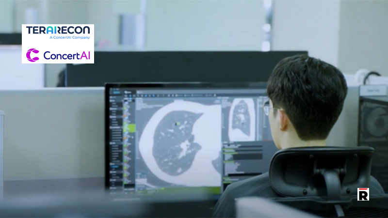 ConcertAI's TeraRecon adds AI-based oncology contouring capabilities ...