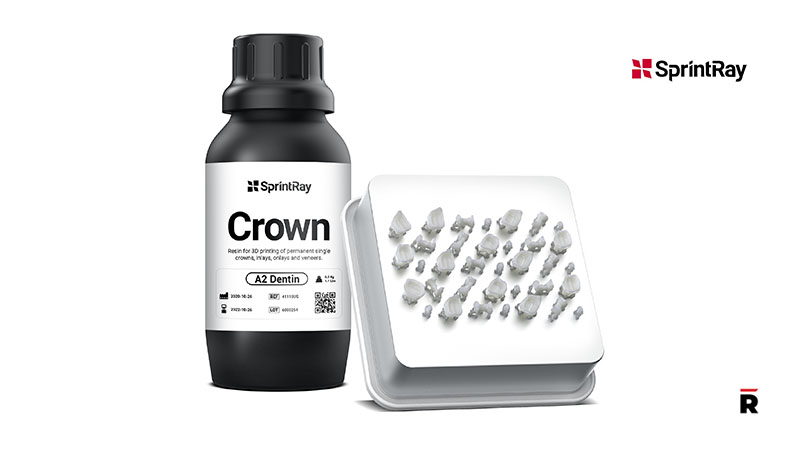 The New Material Sprintray Crown for Permanent Restorations